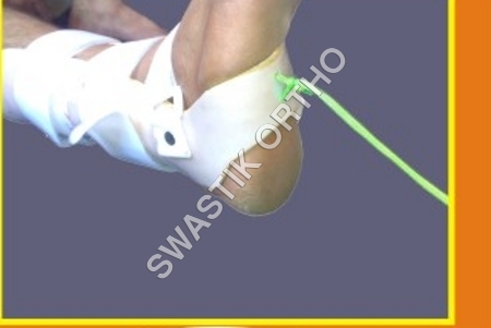 Ankle/skin Traction at Best Price in Sabarkantha, Gujarat | Swastik ...