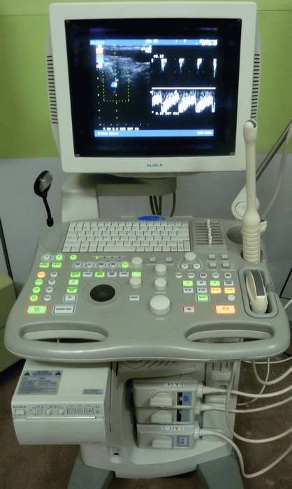 Ultrasound Machine at Best Price in Tel Aviv, Tel Aviv | Msf Medical ...
