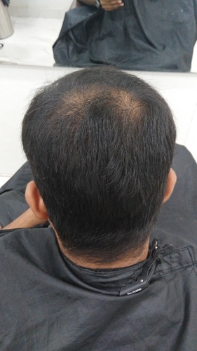 Hair Weaving And Bonding at Best Price in New Delhi | Fusion Hair ...