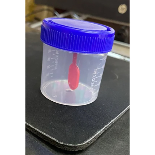 Transparent Plastic Sputum Container at Best Price in Ahmedabad ...