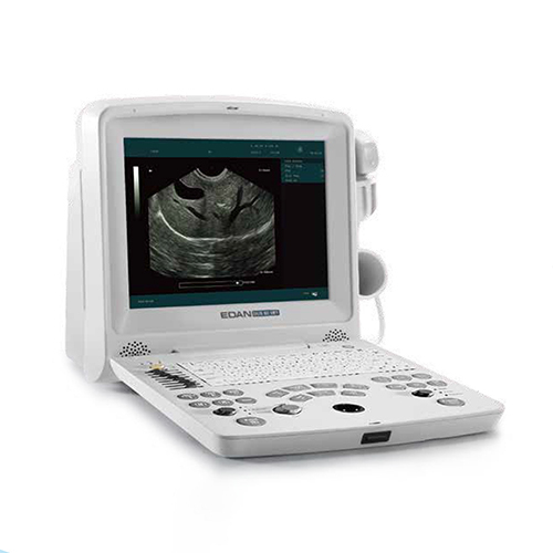 Dus 60 Vet Veterinary Digital Ultrasonic Imaging System - Color: White ...