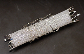 Mesh Covered Stent System at Best Price in Surat | Nano Therapeutics ...