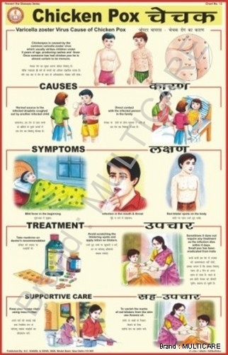 Chicken Pox Chart at Best Price in New Delhi, Delhi | Multicare ...