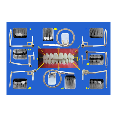 X Ray Sensor Holders And Bite Wing at Best Price in Mumbai | Taiwan ...