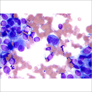 Jenners Stain at Best Price in Mumbai, Maharashtra | Neha-chem