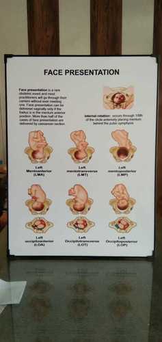 Chart Of Breech Presentation at Best Price in Ambala Cantt | R. K ...