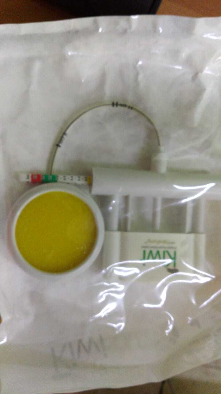 Kiwi Cup Vacuum Delivery System at 4500.00 INR in Bengaluru | Krishco ...