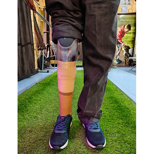 Below Knee Prosthesis at 70000.00 INR in Hyderabad, Telangana | Reboot ...