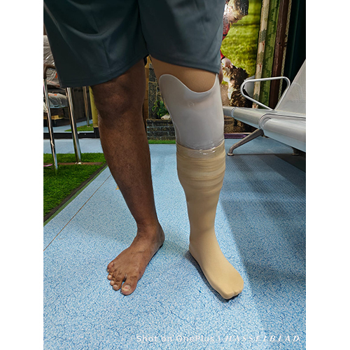 Below Knee Prosthesis at 70000.00 INR in Hyderabad, Telangana | Reboot ...