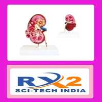 Kidney Cyst Model at Best Price in Greater Noida, Uttar Pradesh | Rx2 Sci-tech India