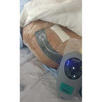 Medical Vac Dressing - Color: Black at Best Price in New Delhi | Triage ...